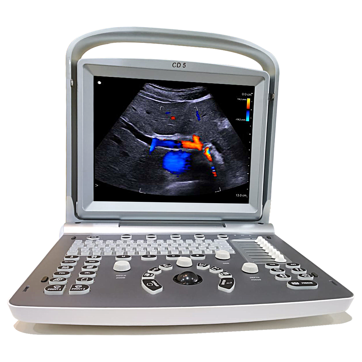 colour doppler